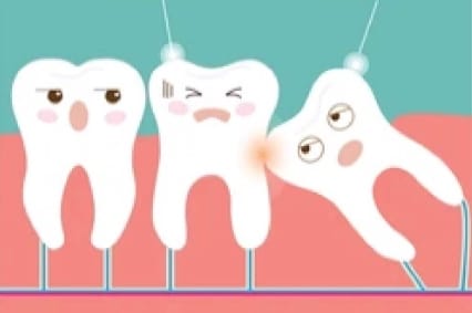 Wisdom Teeth Removal | Pain Relief | Dr Alps Thakkar